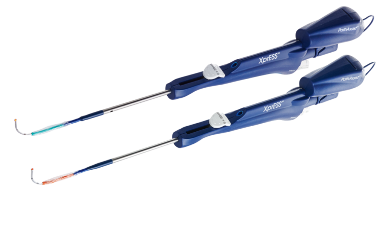 Balloon Sinuplasty St. Petersburg | Chronic Sinusitis St. Petersburg